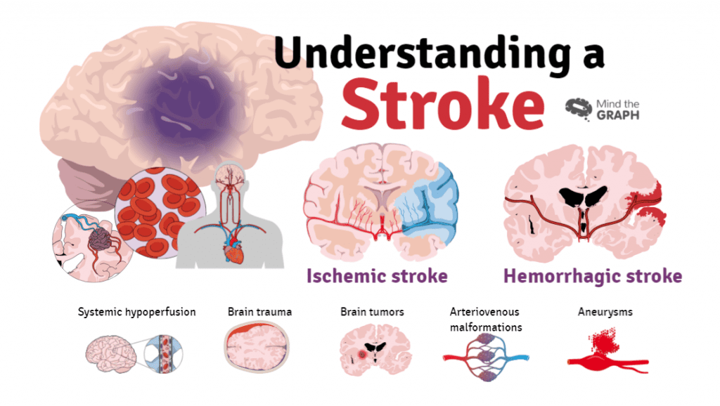 Recognizing the Signs of a Stroke - Leading Edge Senior Care