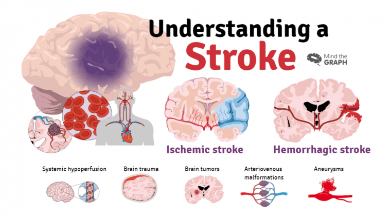Recognizing the Signs of a Stroke - Leading Edge Senior Care